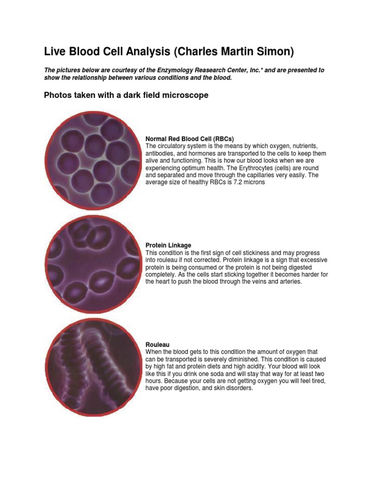 Live Blood Analysis | PDF | Platelet | Blood