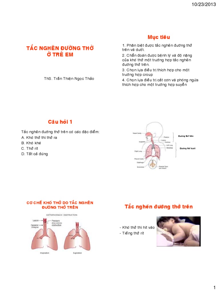 Airway Obstruction Handout