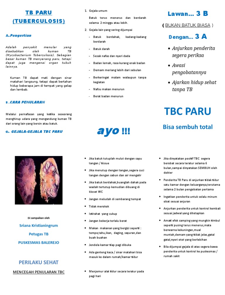 Leaflet TBC Paru | PDF
