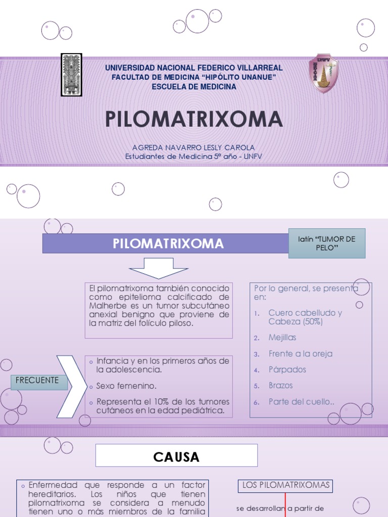 Pilomatrixoma | PDF | Piel | Cáncer