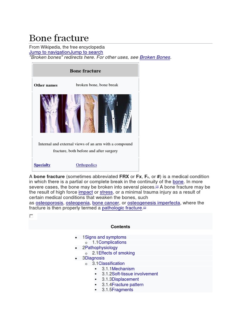 Bone Fracture | PDF | Musculoskeletal System | Skeletal System