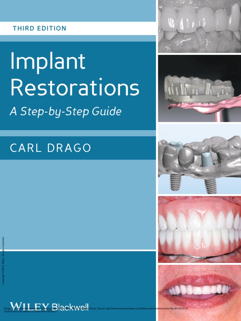 Implant | PDF | Prosthodontics | Dental Implant