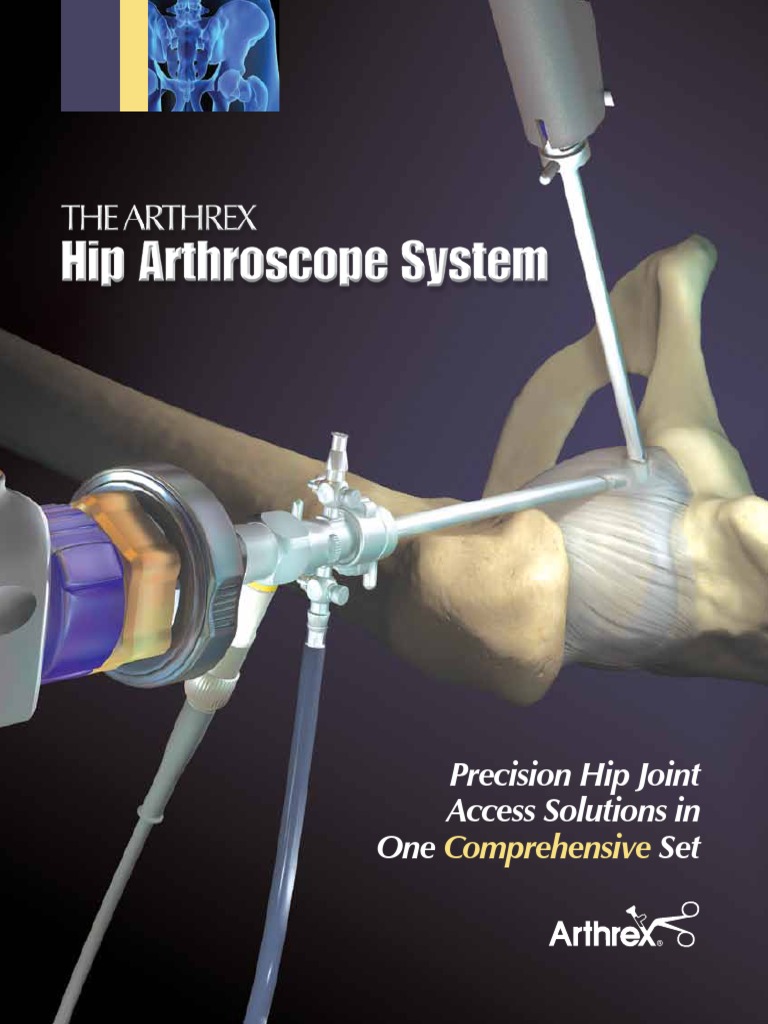 The Arthrex Hip Arthroscope System | PDF | Equipment