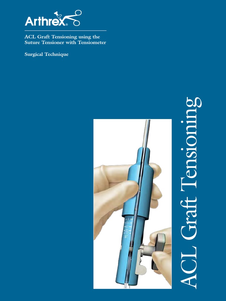 ACL Graft Tensioning Using The Suture Tensioner With Tensiometer | PDF ...