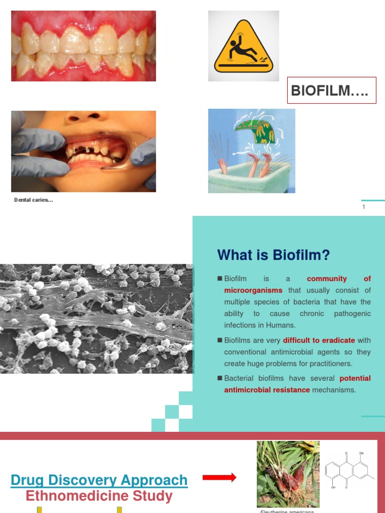 Biofilm .: Dental Caries | PDF | Biofilm | Clinical Pathology