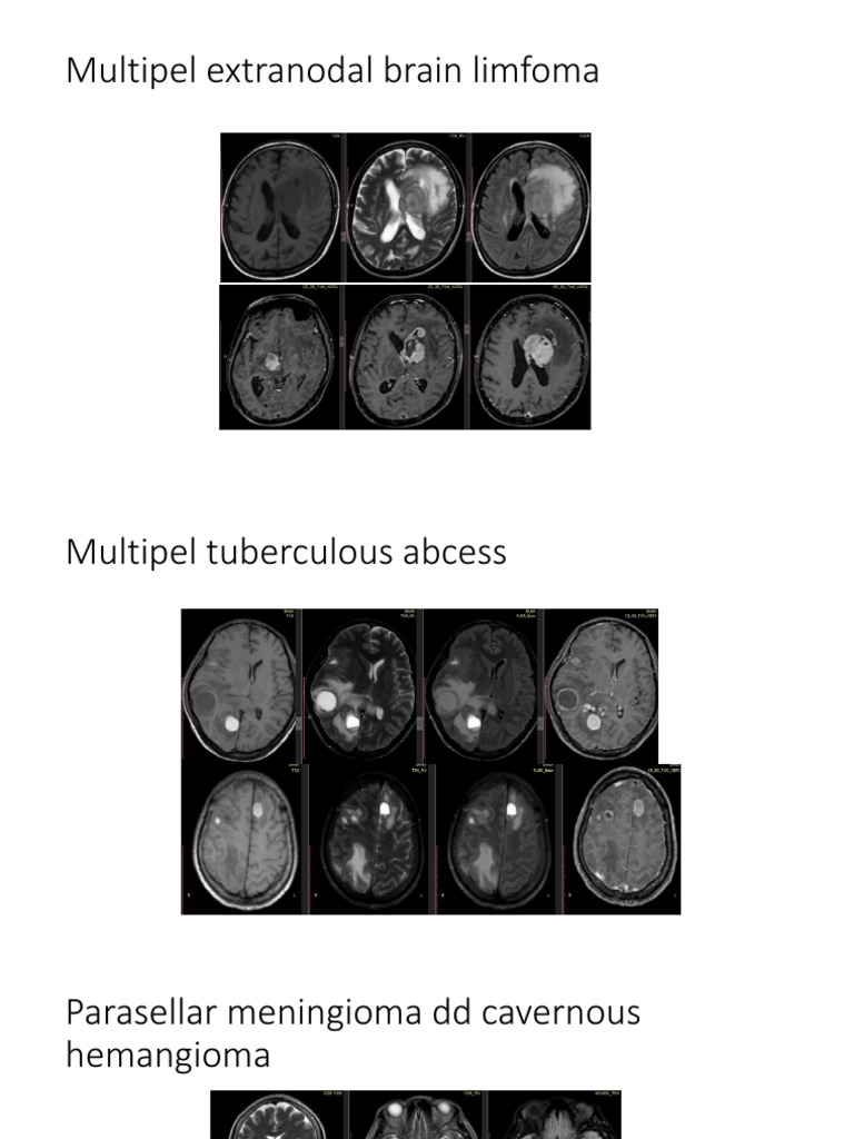 Soal Ne Mri | PDF