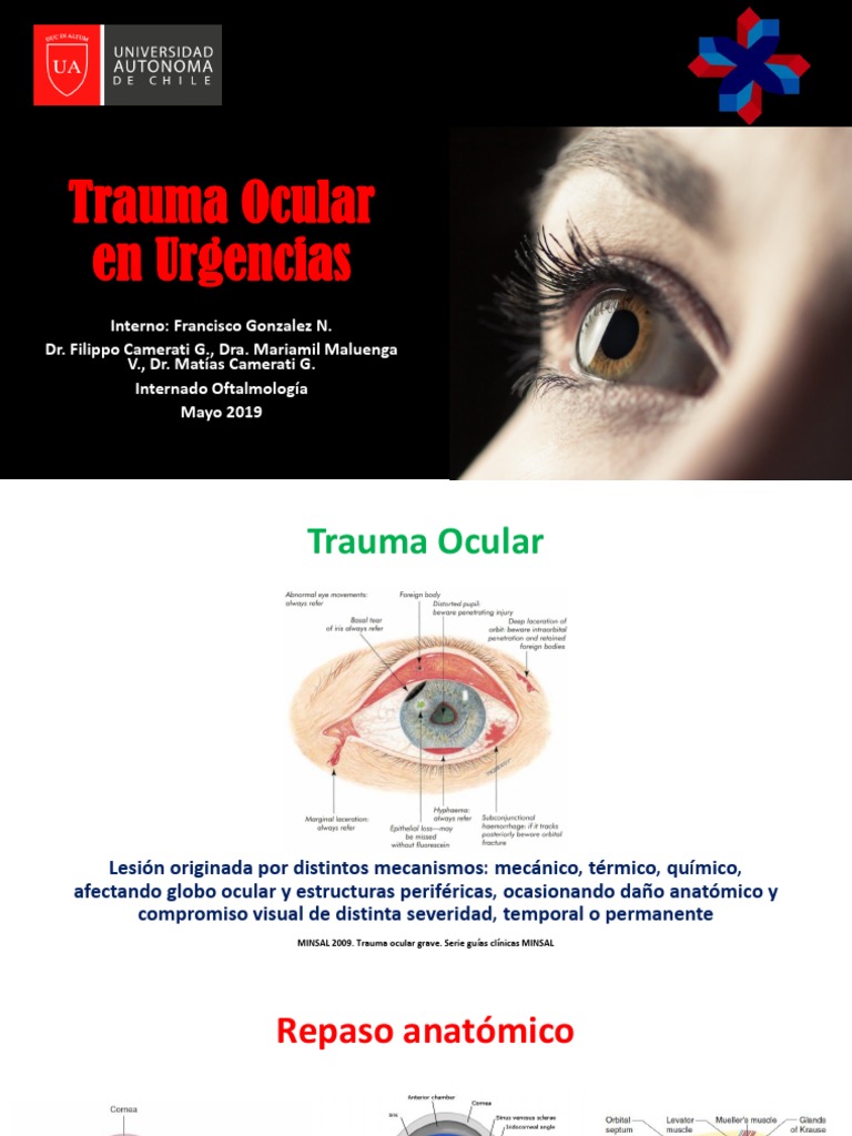 Trauma Ocular | PDF | Ojo | Ojo humano