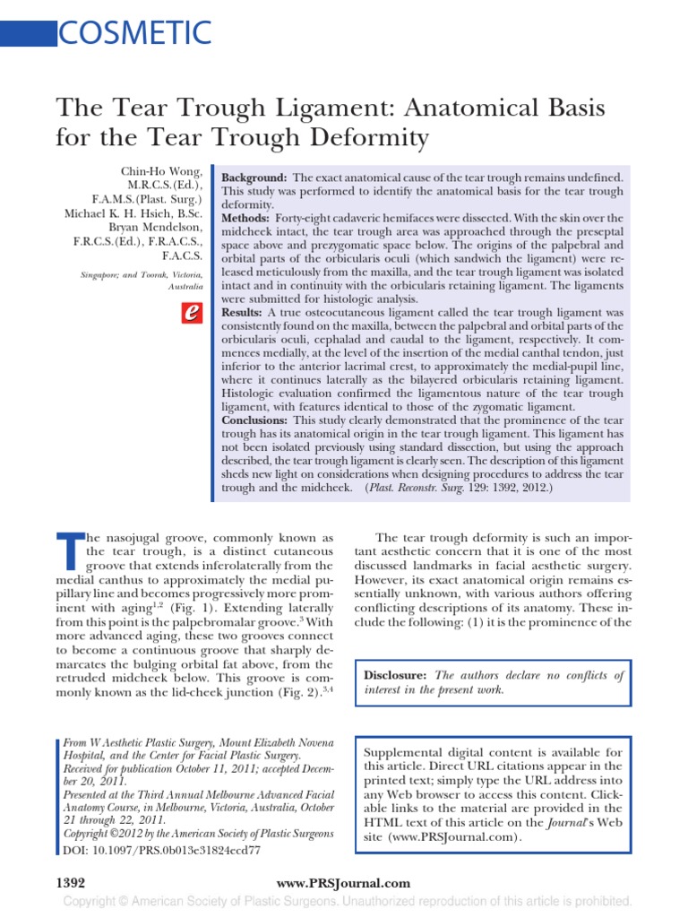 The Tear Trough Ligament: Anatomical Basis For The Tear Trough ...