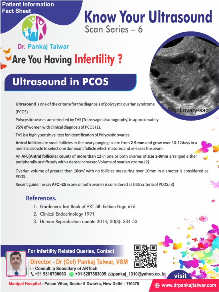 PCOS Ultrasound Diagnosis Criteria | PDF