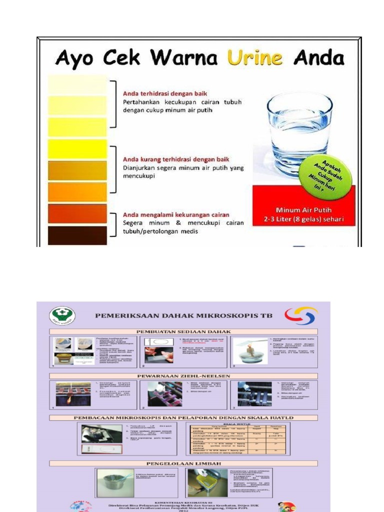 Poster Urine | PDF
