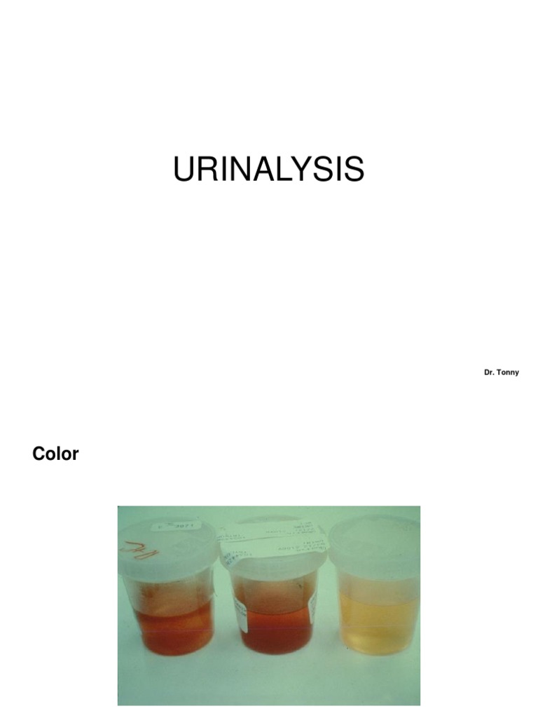 Urinalysis: Dr. Tonny | PDF
