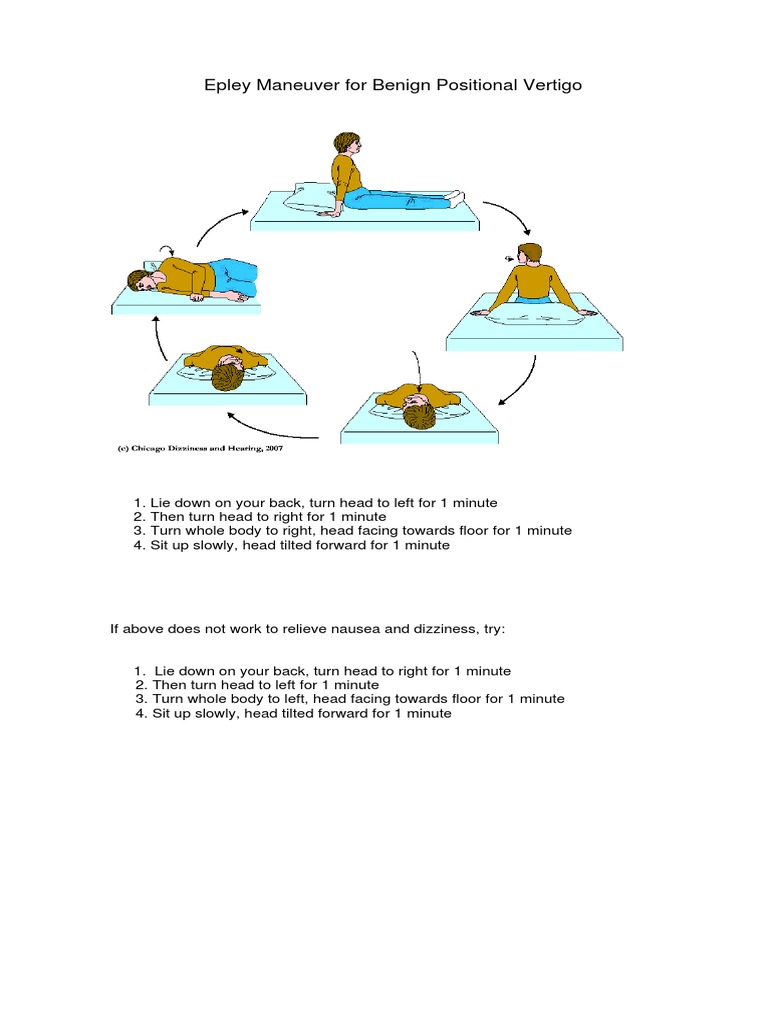 Epley Maneuver For Benign Positional Vertigo | PDF