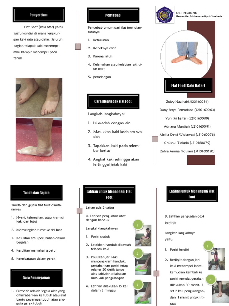 Leaflet Flat Foot Fixx | PDF
