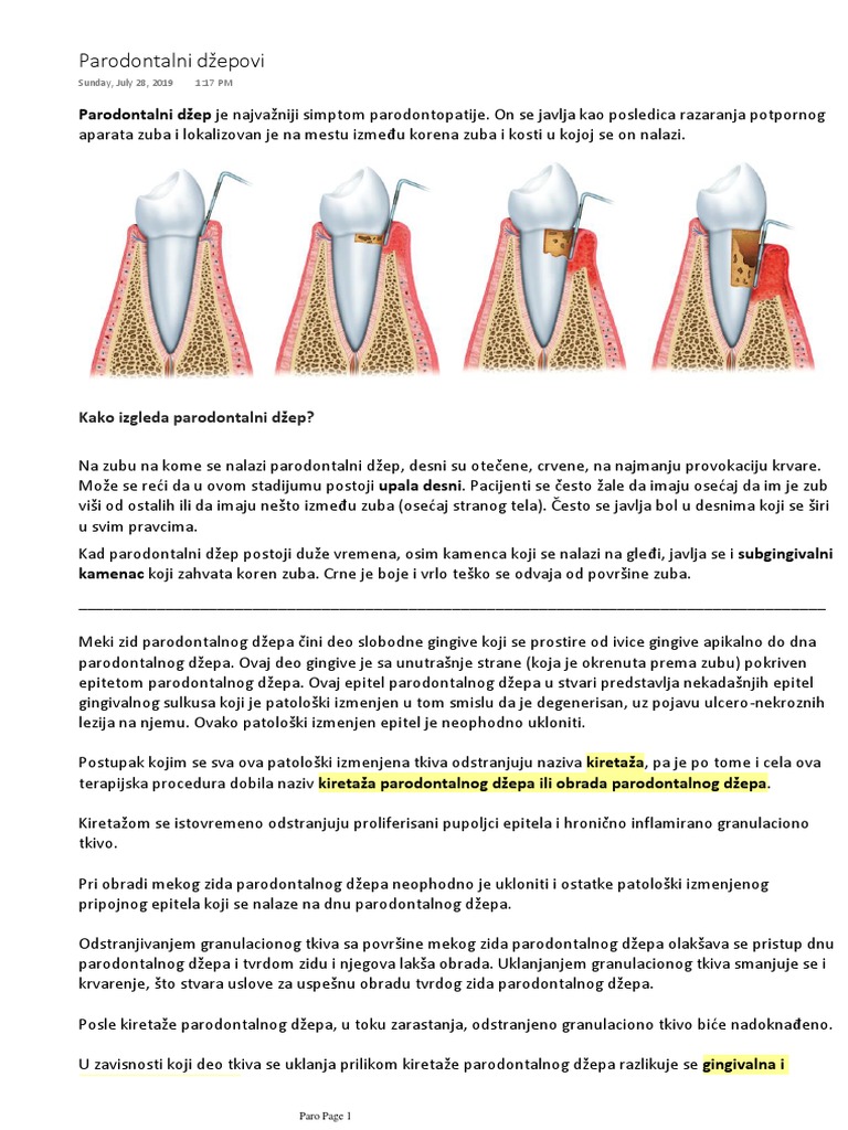 Parodontalni Džepovi | PDF