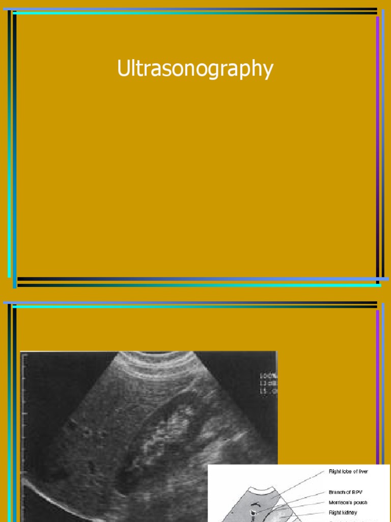 Ultrasonography | PDF
