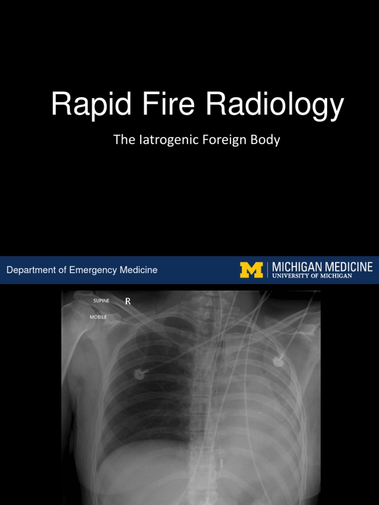 Rapid Fire Radiology Khan | PDF | Artificial Cardiac Pacemaker | Atrium ...
