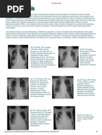 Signo de Mapache | PDF | Lesión | Medicina