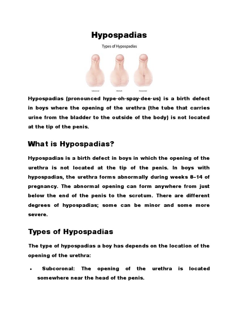 Hypospadias | PDF | Urination | Pregnancy