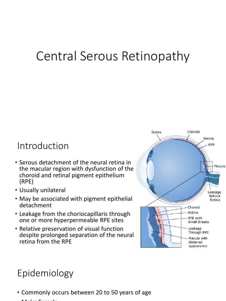 Central Serous Retinopathy | PDF | Retina | Medicine