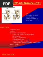 Accolade System Surgical Technique | PDF | Hip | Anatomical Terms Of Motion