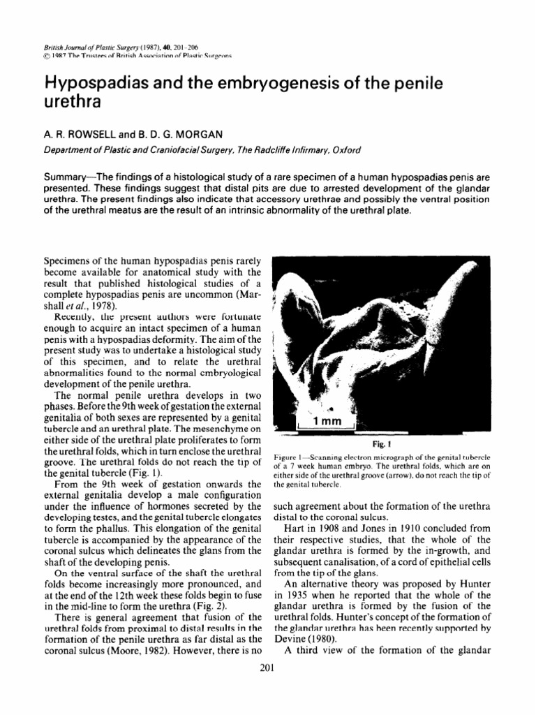 Hypospadias and The Embryogenesis of The Penile Urethra | PDF | Penis ...