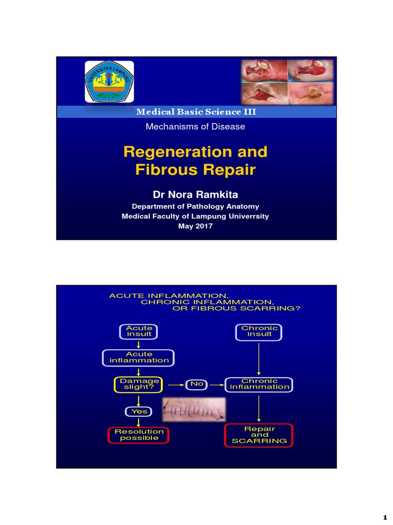 Mechanisms of Disease: Repair & Regeneration | PDF | Wound Healing ...