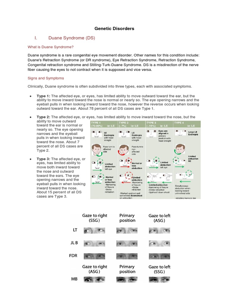 I. Duane Syndrome (DS) : Genetic Disorders | PDF | Parkinson's Disease ...