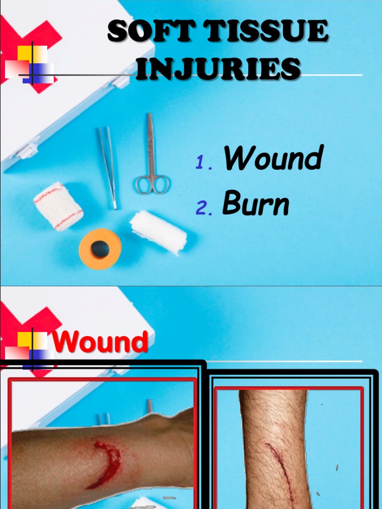 Wounds Burns | PDF | Burn | Wound