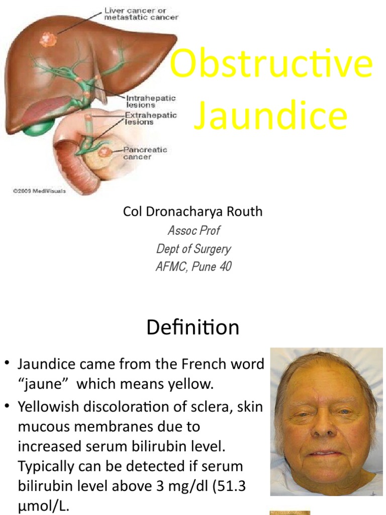 Obstructive Jaundice | PDF | Organ (Anatomy) | Digestive System