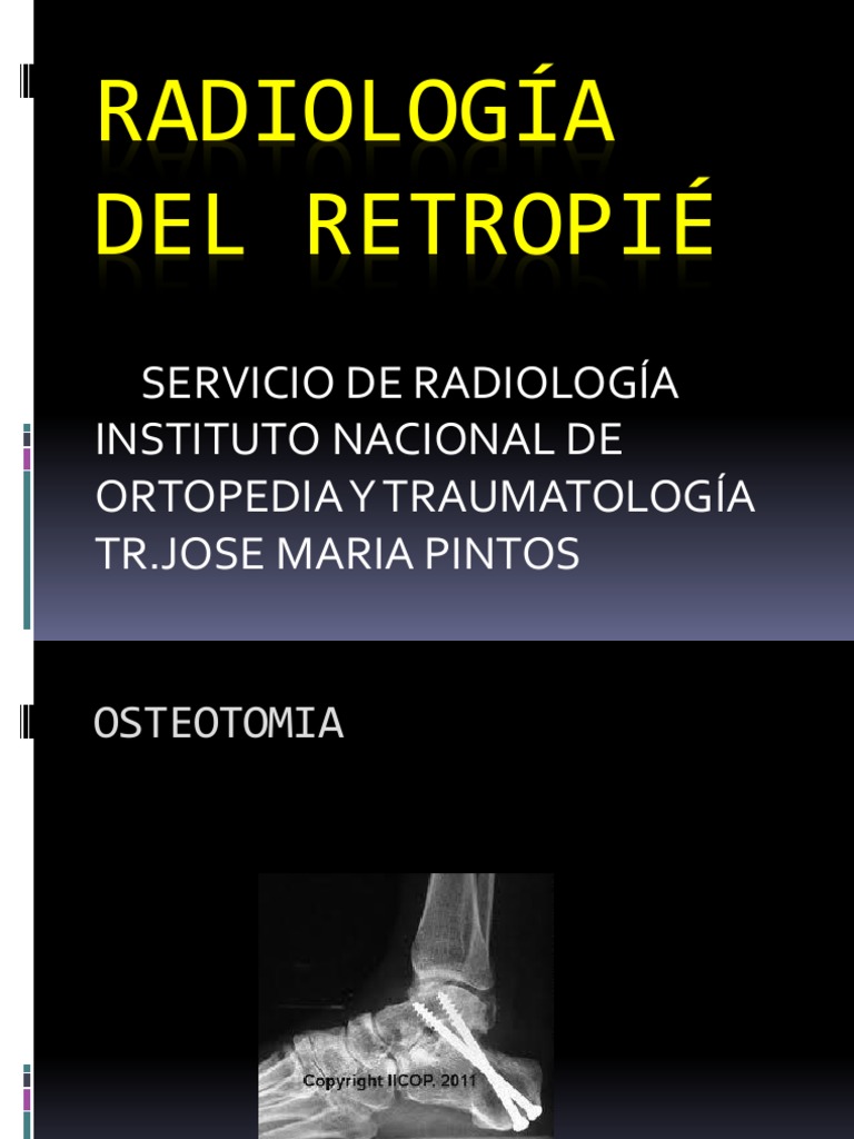 9 Retropie | PDF | Pie | Tobillo