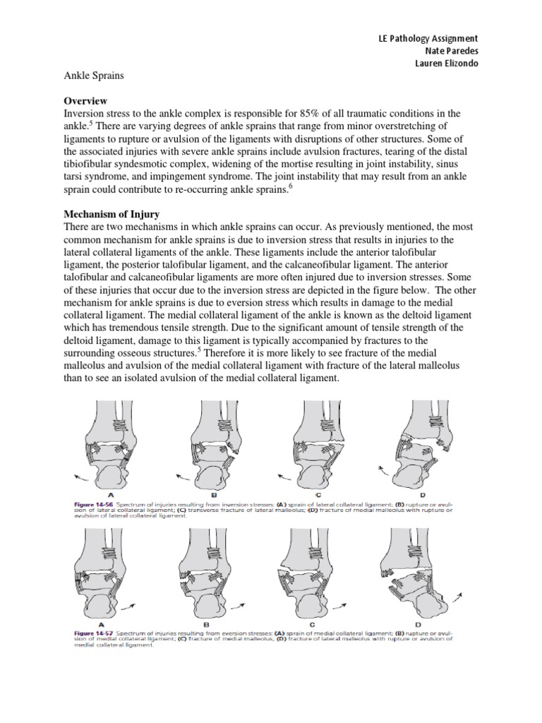Ankle Sprains | PDF | Ankle | Medical Specialties