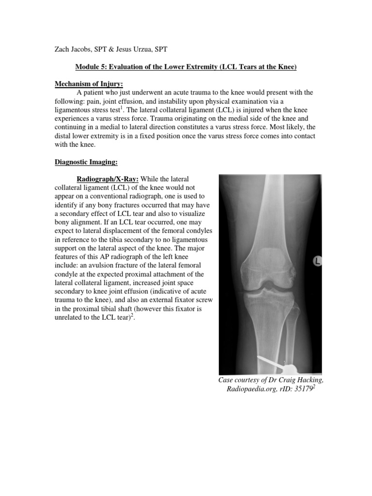 Module 5: Evaluation of The Lower Extremity (LCL Tears at The Knee ...