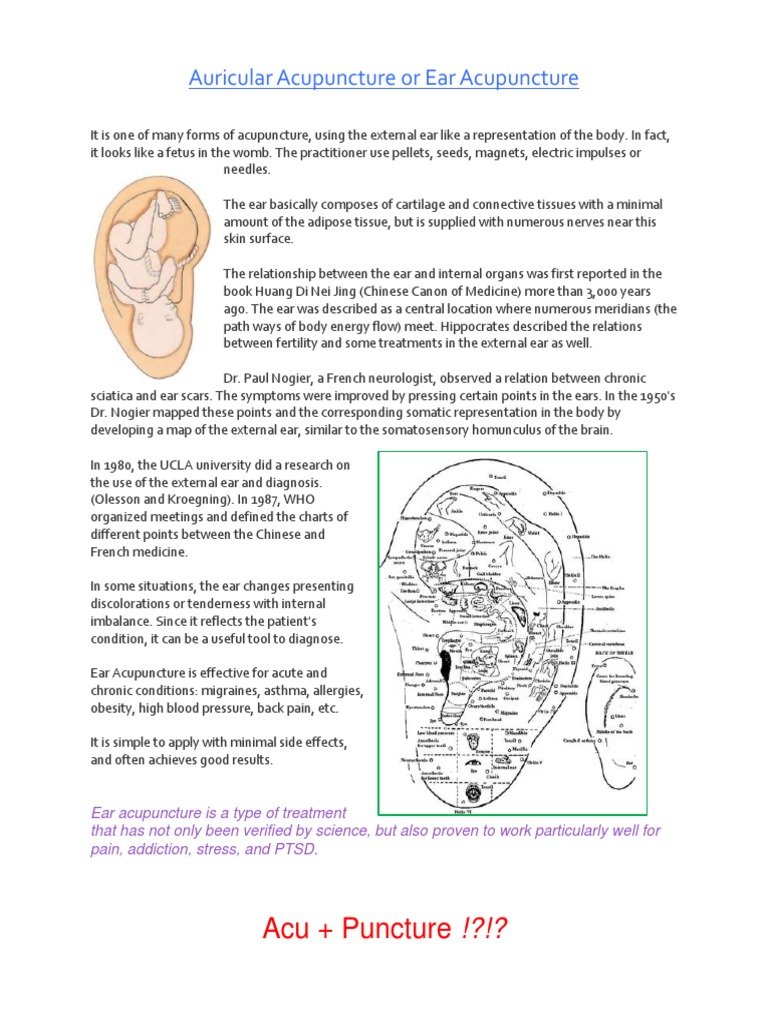 Auricular Acupuncture or Ear Acupuncture: Acu + Puncture !?!? | PDF ...