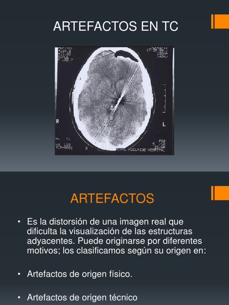 Artefactos en TC | PDF | Fotón | Medición