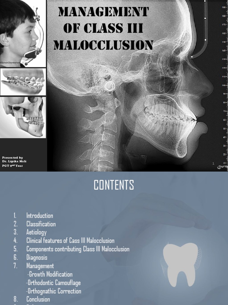 Treatment of Class III Malocclusion | PDF | Animal Anatomy | Dentistry ...