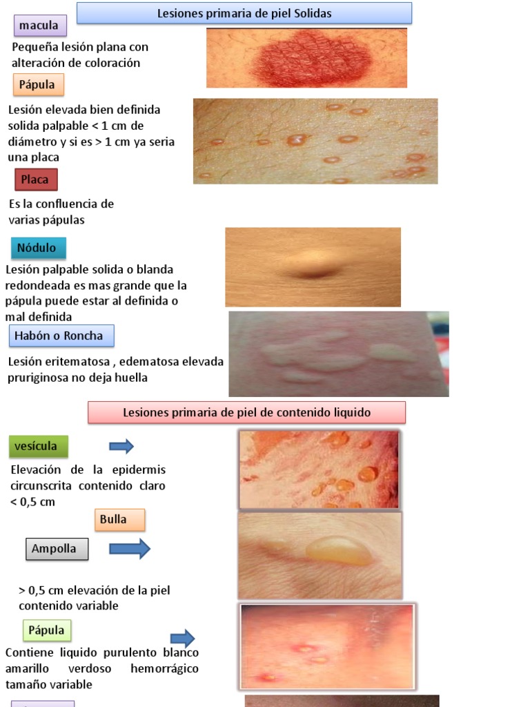 Lesiones Primaria de Piel Solidas | PDF