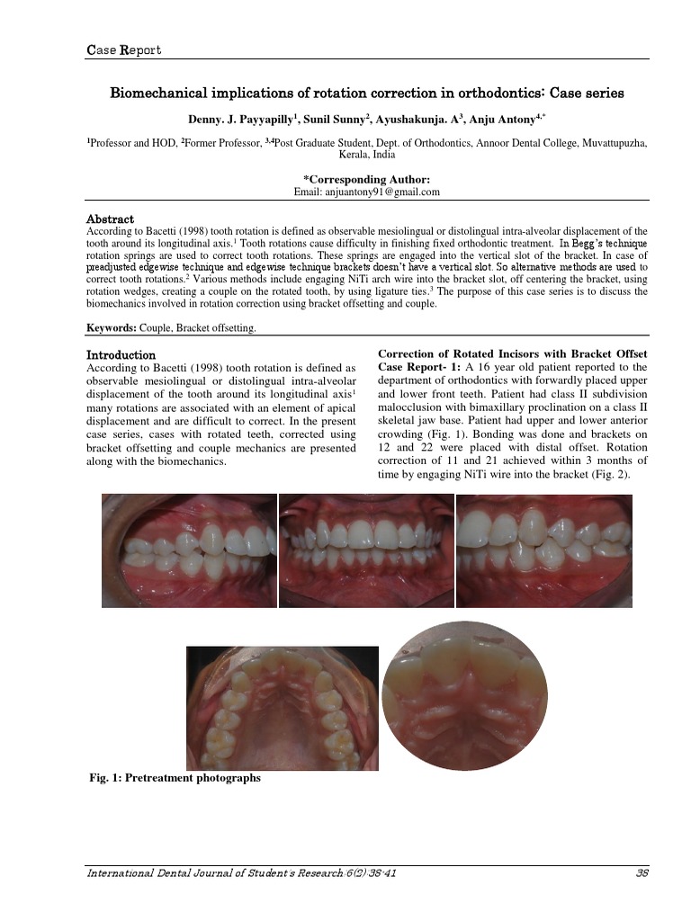 Biomechanical Implications of Rotation Correction in Orthodontics ...