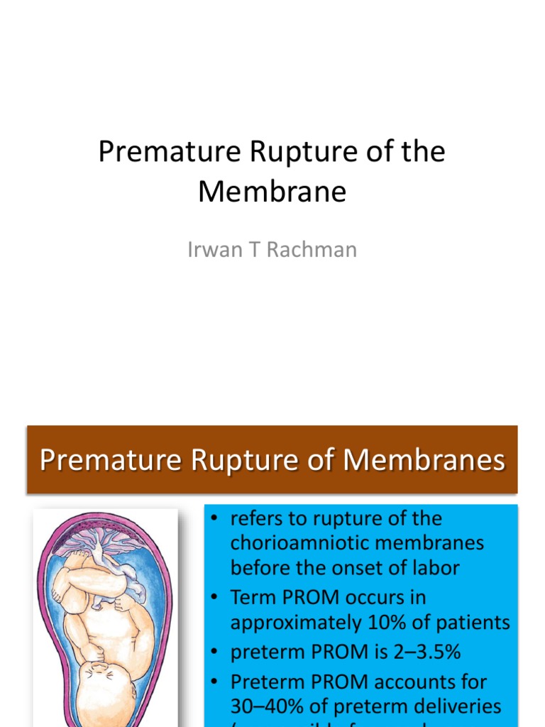 Premature Rupture of The Membrane | PDF | Preterm Birth | Childbirth