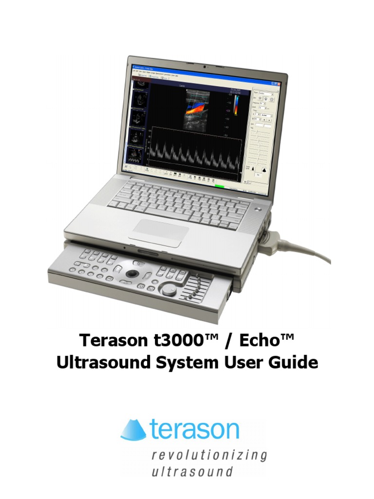 TeraSon t3000 | PDF | Medical Ultrasound | Software