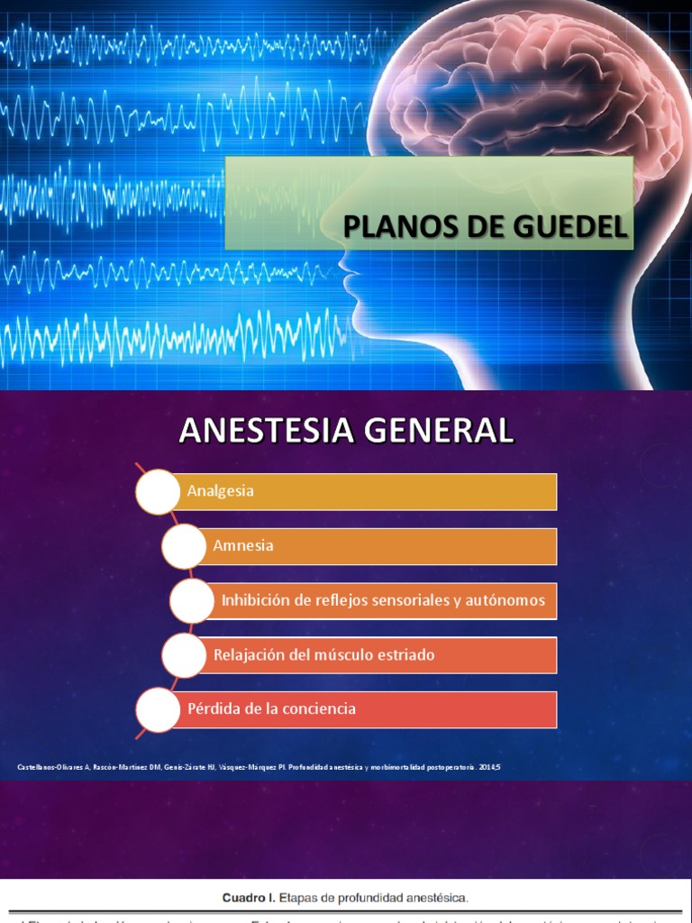 Planos de Guedel | PDF