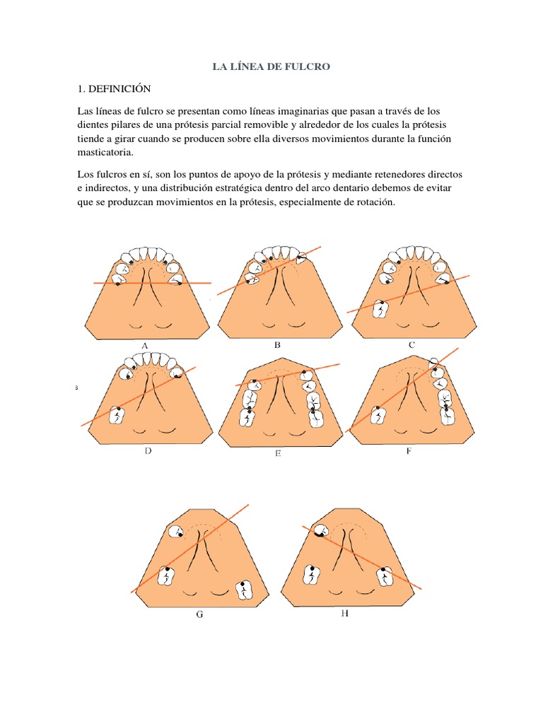 linea de fulcrum