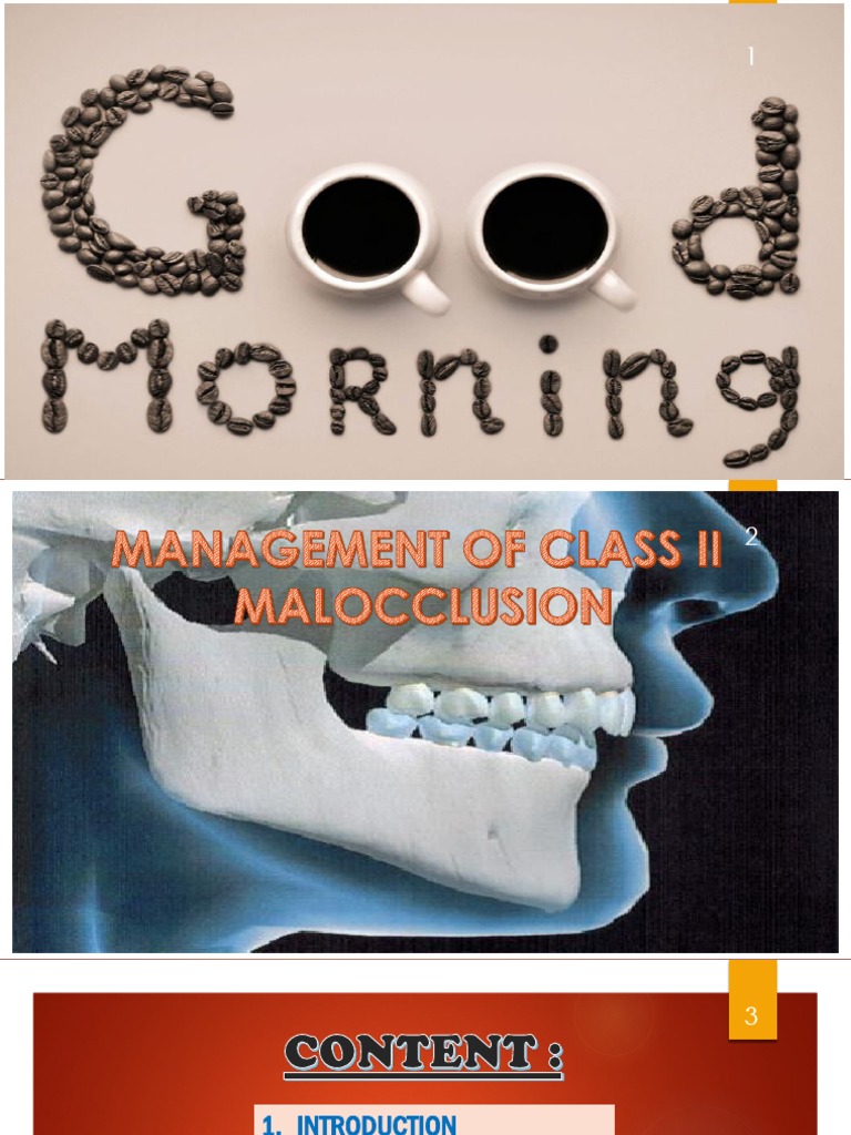 Class II Malocclusion | PDF | Orthodontics | Dental Anatomy