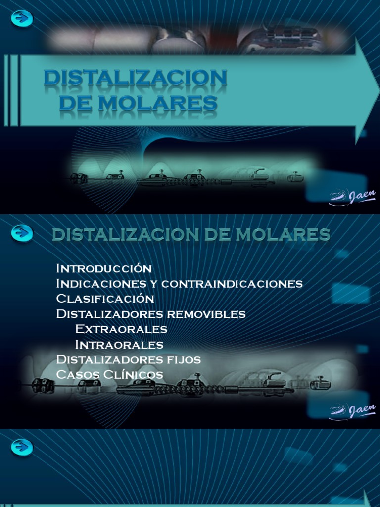 Distalizacion de Molares | PDF | Ortodoncia | Boca