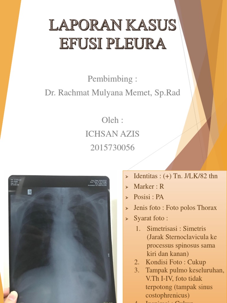 Laporan Kasus Radiologi Efusi Pleura | PDF