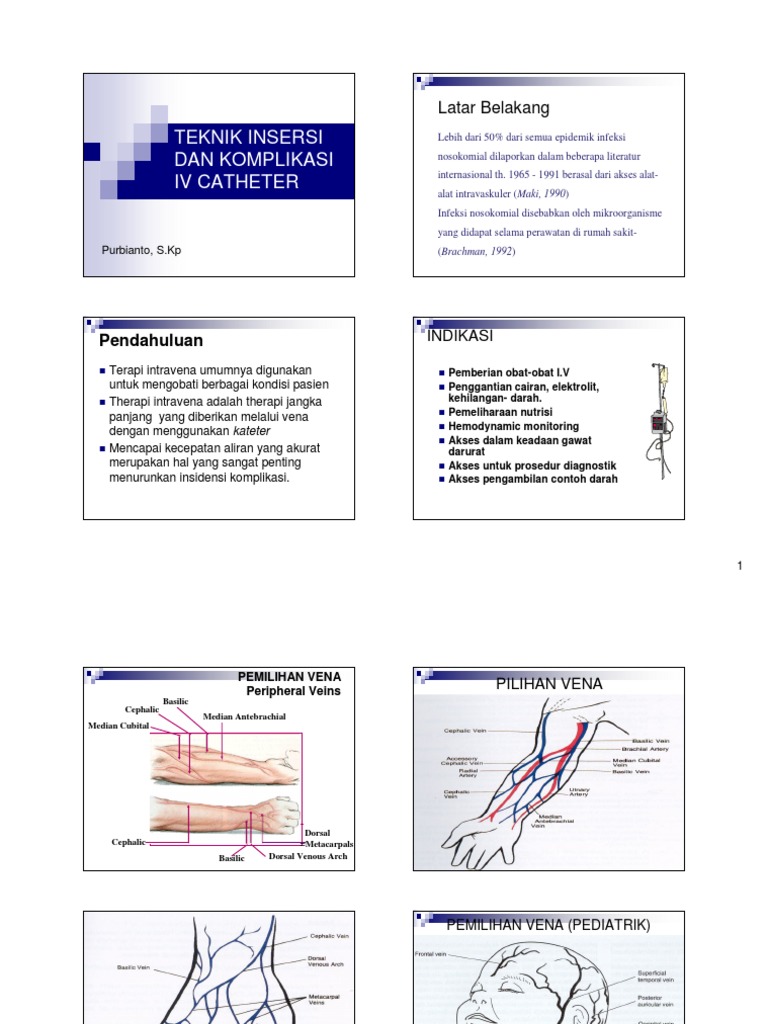 Teknik Insersi IV | PDF