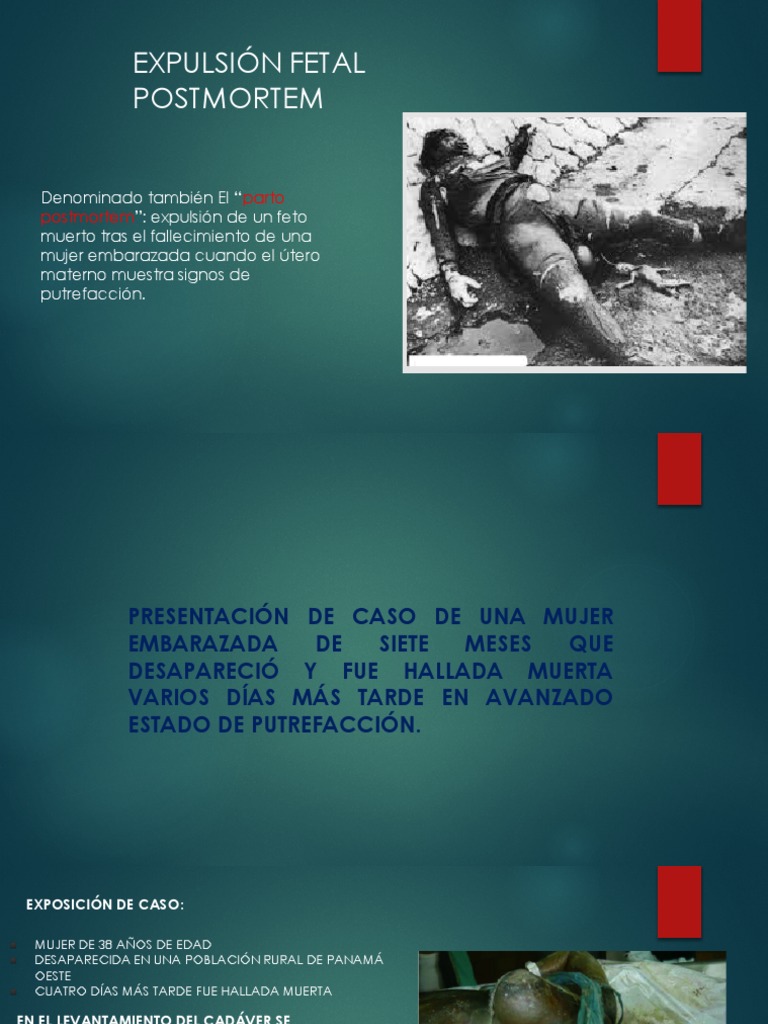 Expulsion Fetal Postmorten | PDF