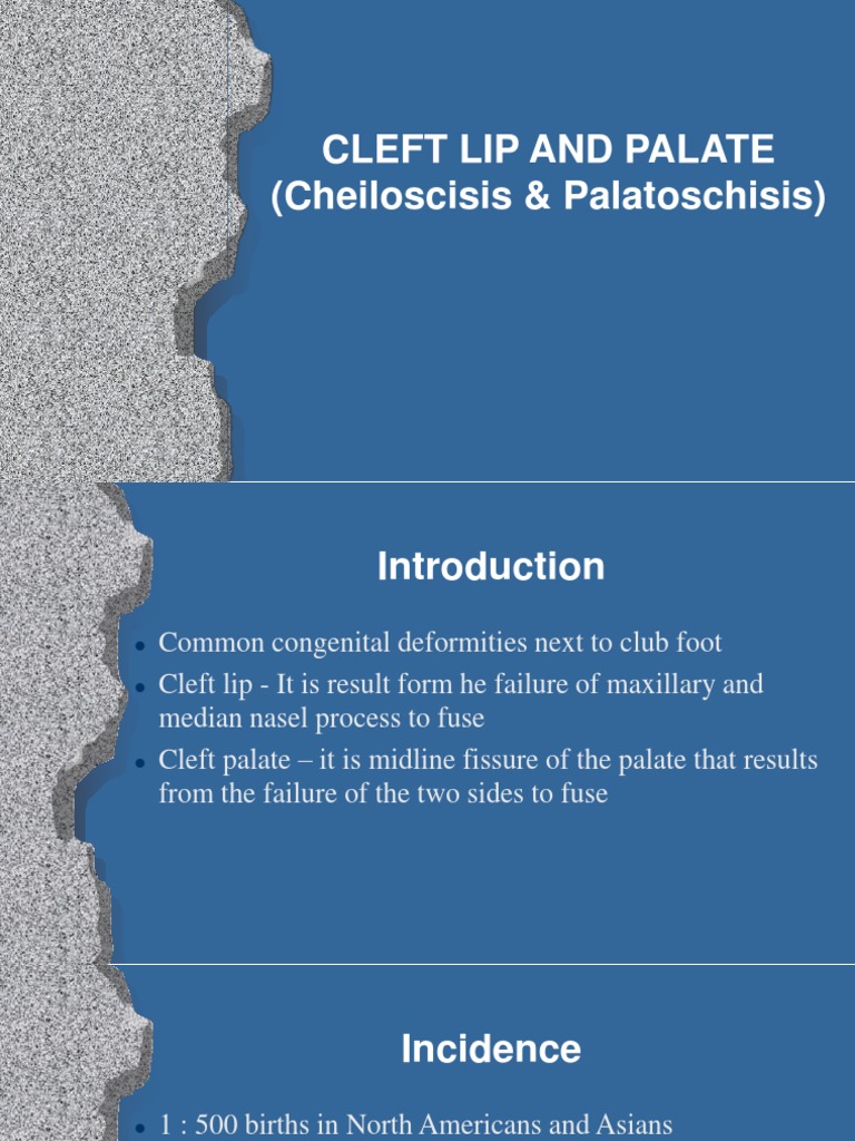 Cleft Lip and Palate (Cheiloscisis & Palatoschisis) | PDF | Medicine ...