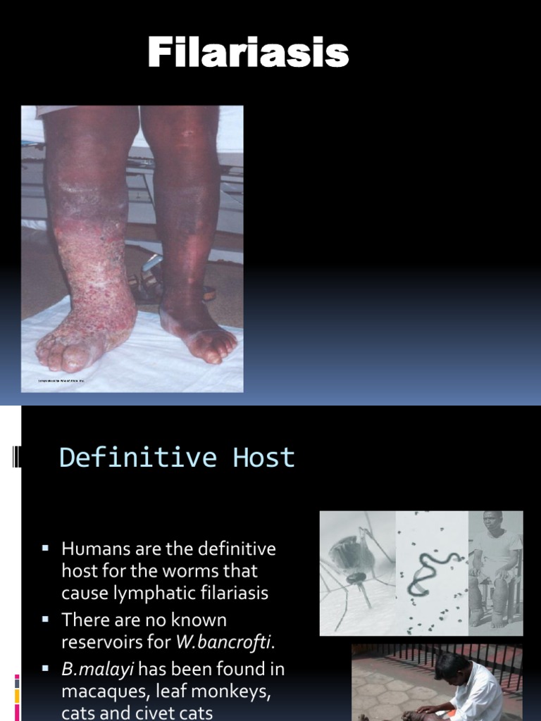 Filariasis | PDF | Microbiology | Animal Diseases