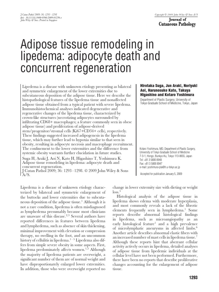 Adipose Tissue Remodeling in Lipedema: Adipocyte Death and Concurrent ...