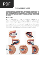 Técnica de Bass Modificada | PDF | Diente | Odontología